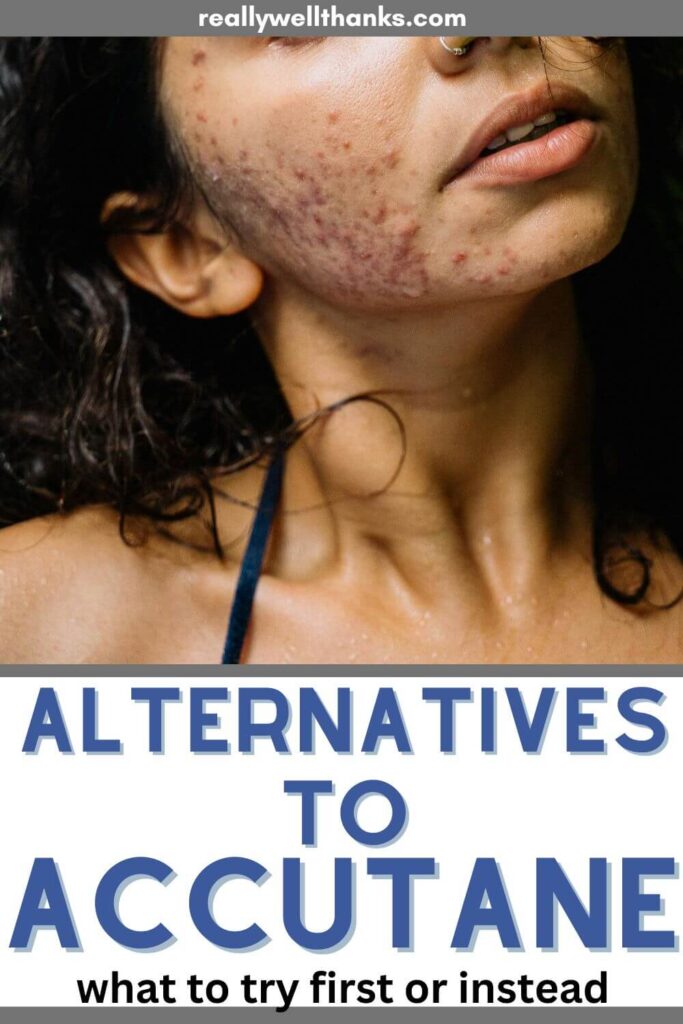 Alternatives to Accutane Treatment: Effective For Acne - really well ...